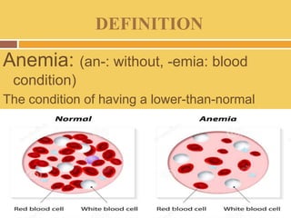 Anemia | PPTX