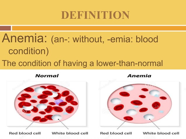 Anemia | PPTX | Blood Disorders | Diseases and Conditions