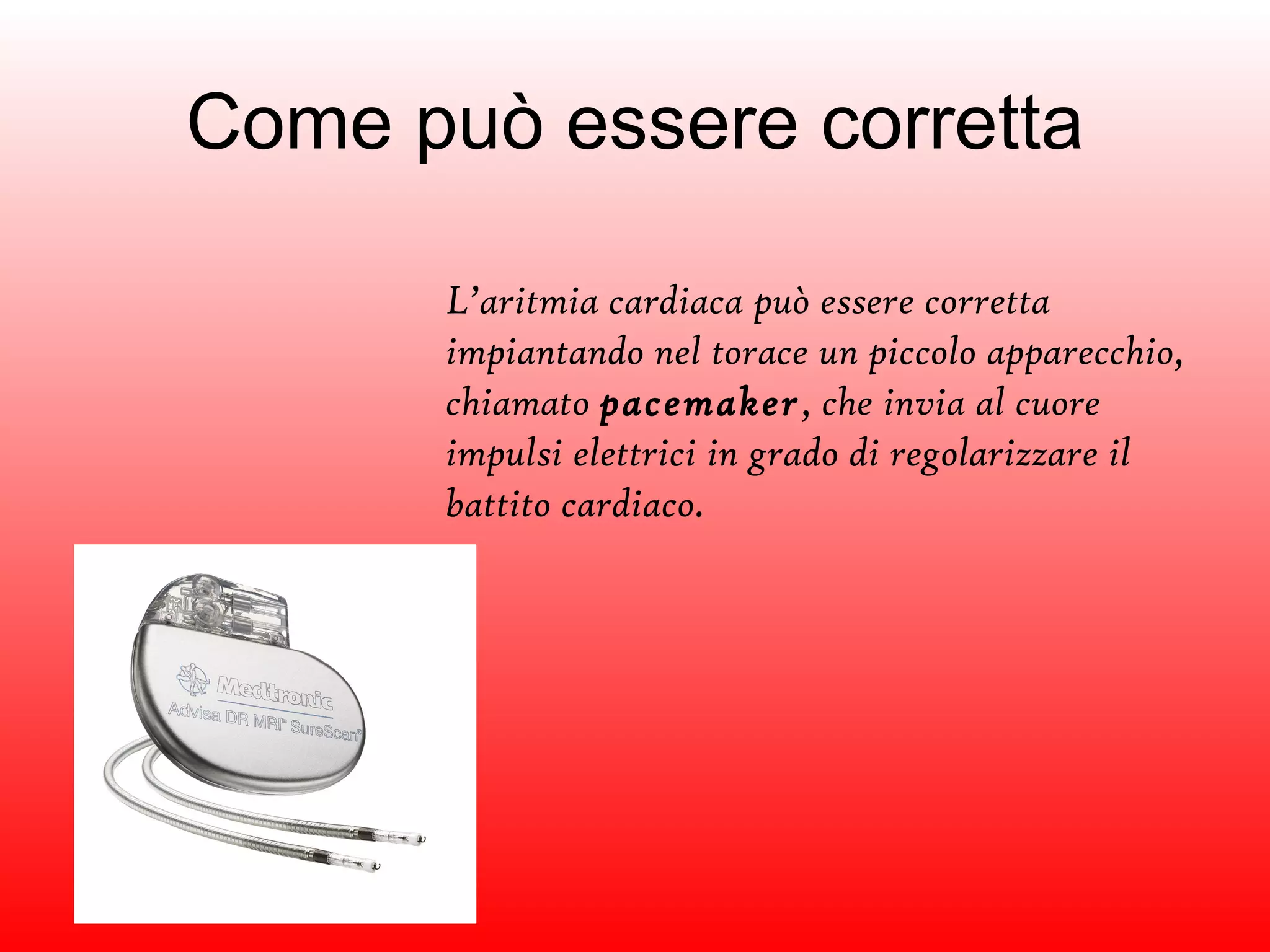 Biologia, 2012, le aritmie cardiache, nadia c., 3 liceo scienze soc | PPT