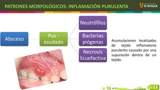 Fisiopatologia y Biologia de la inflamación | PPTX