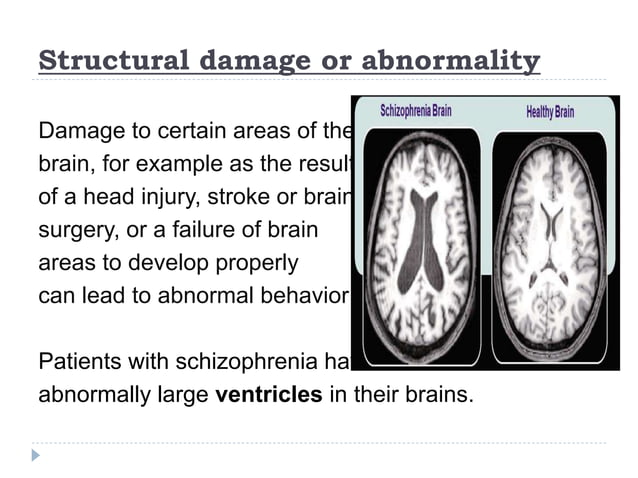 Biological Approach in explaining Abnormality & Psychological Disorders ...