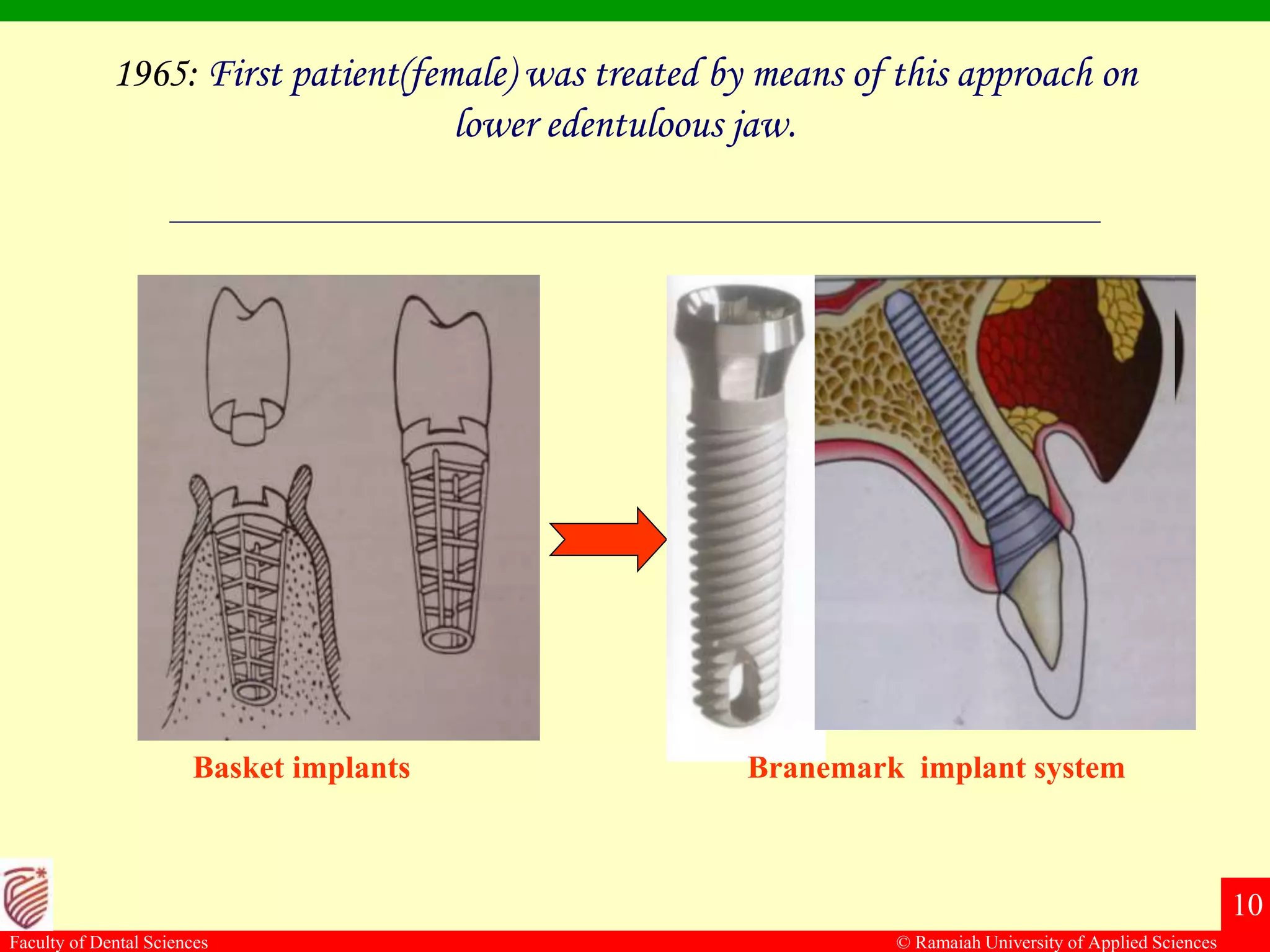 Biological aspect of implant | PPT