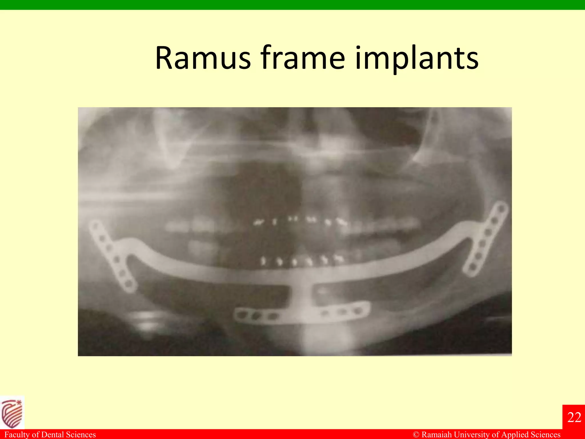 Biological aspect of implant | PPT