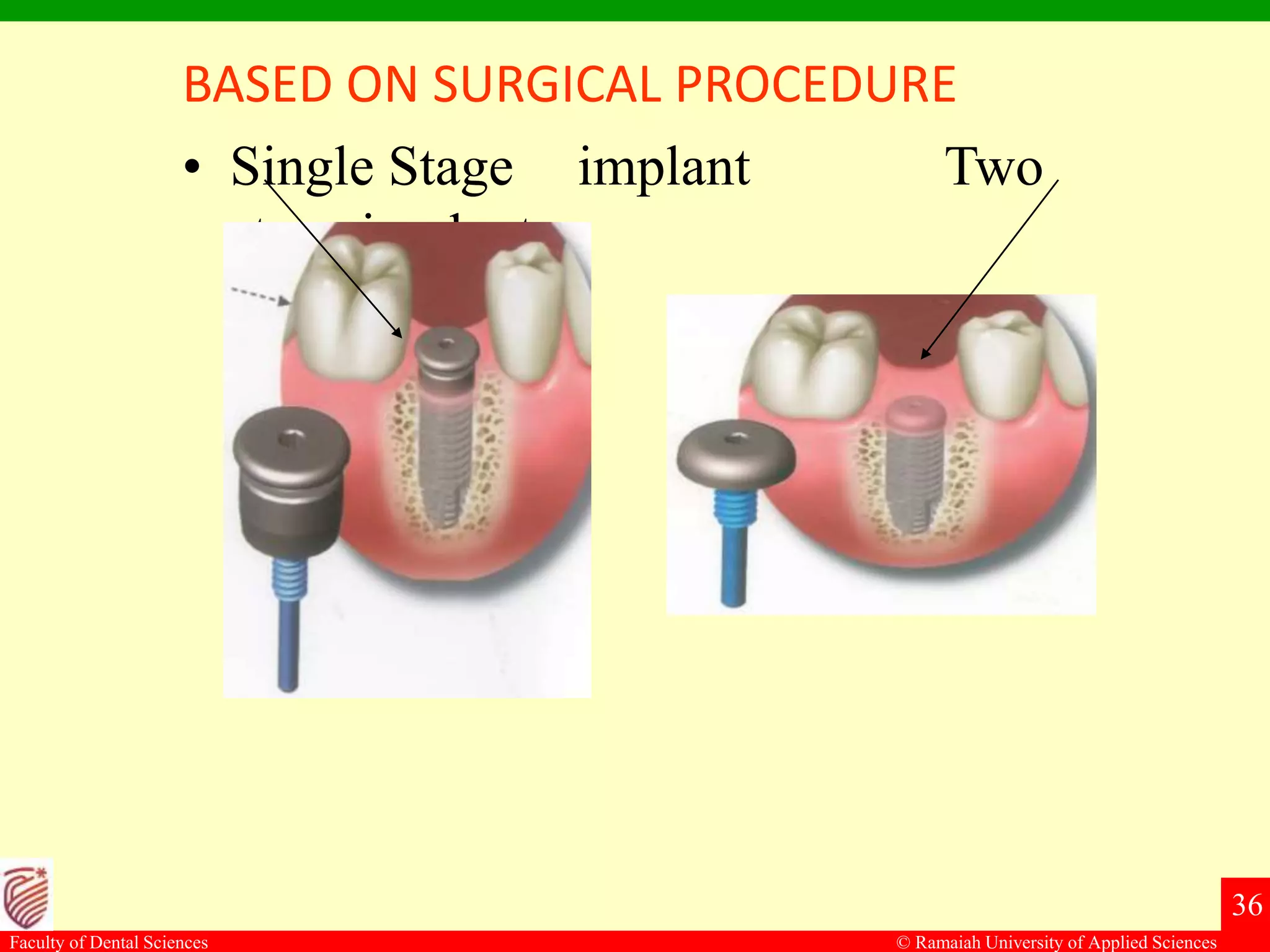 Biological aspect of implant | PPT