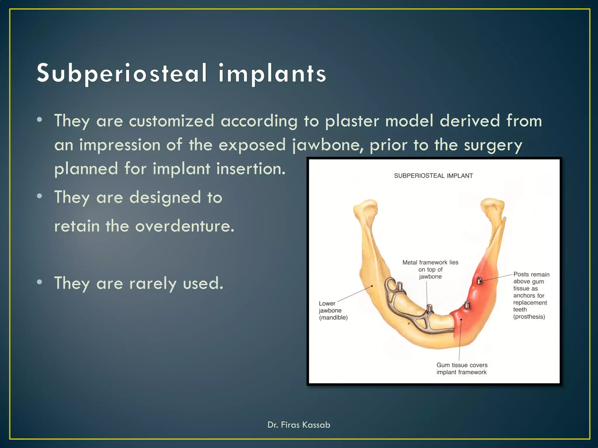 Biological considerations of dental implant | PDF