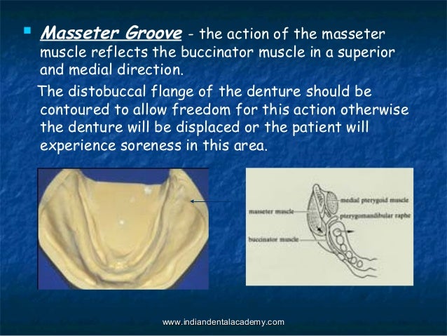 Biological considerations of maxillary and mandibular impressions/cos…