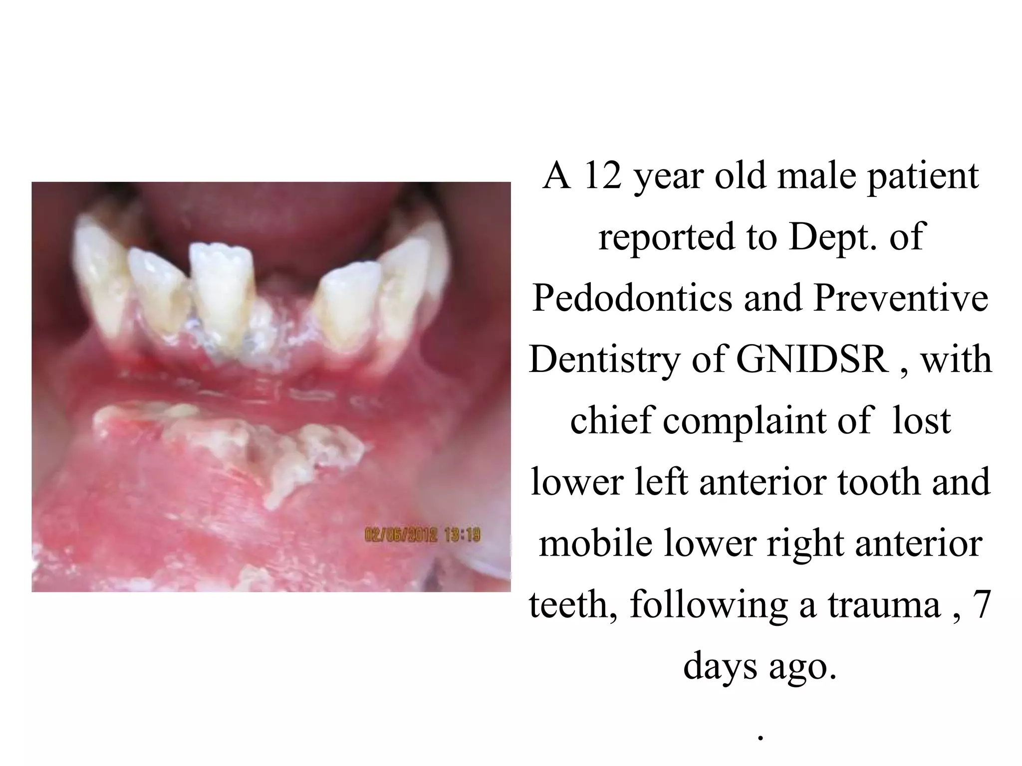 Biological crown | PPTX