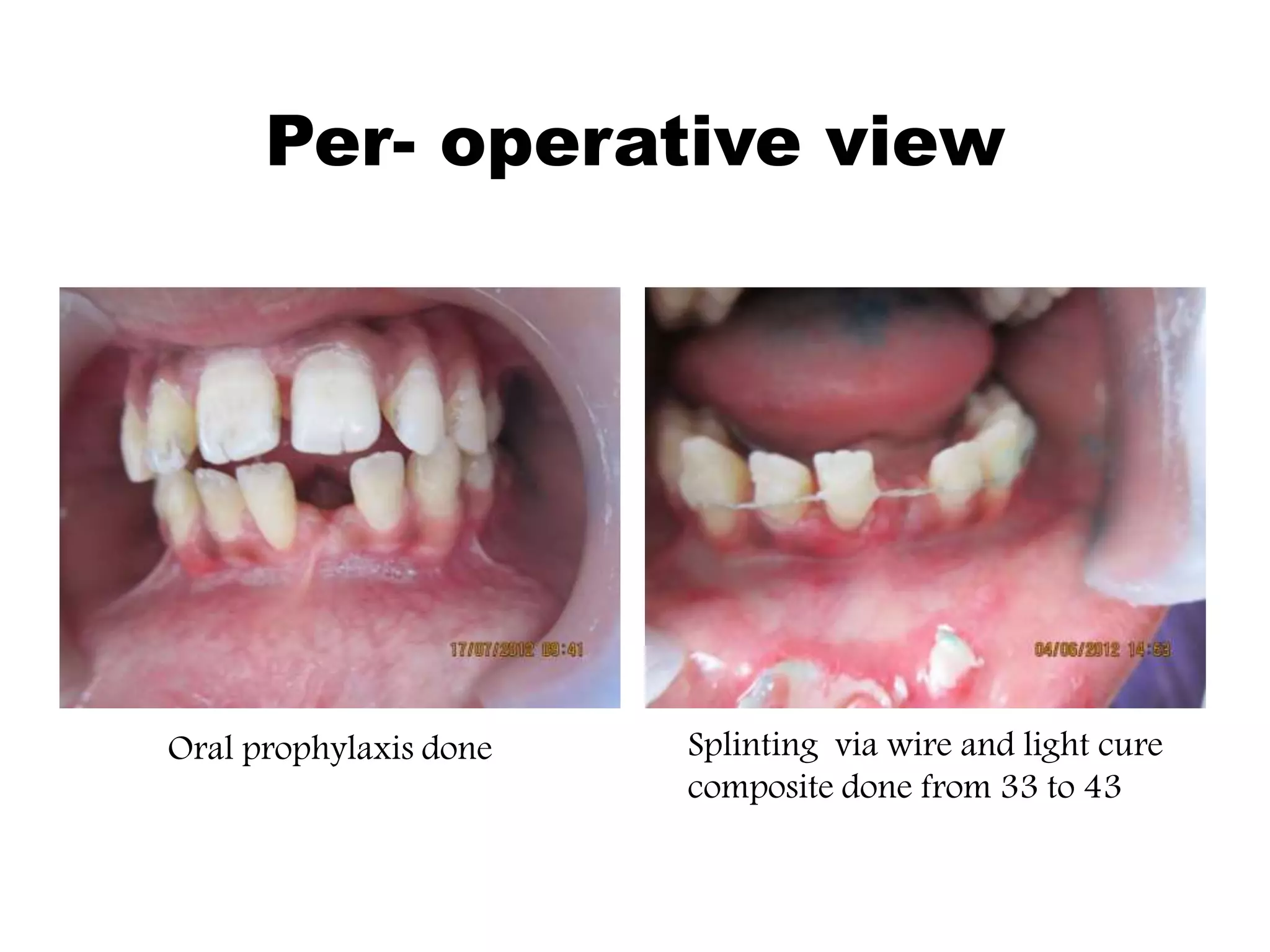 Biological crown | PPTX