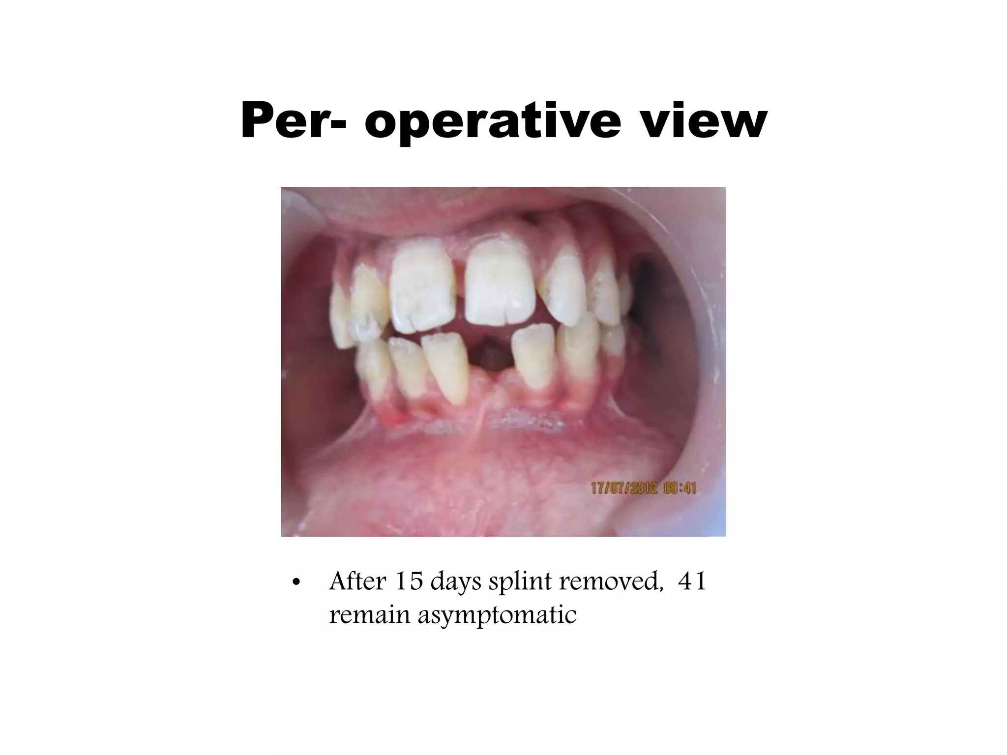 Biological crown | PPTX