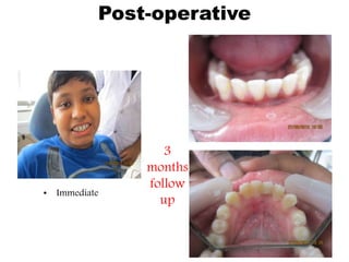 Biological crown | PPTX