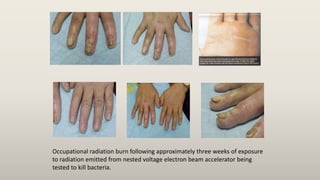 BIOLOGICAL EFFECTS OF RADIATION USHA YADAV.pptx