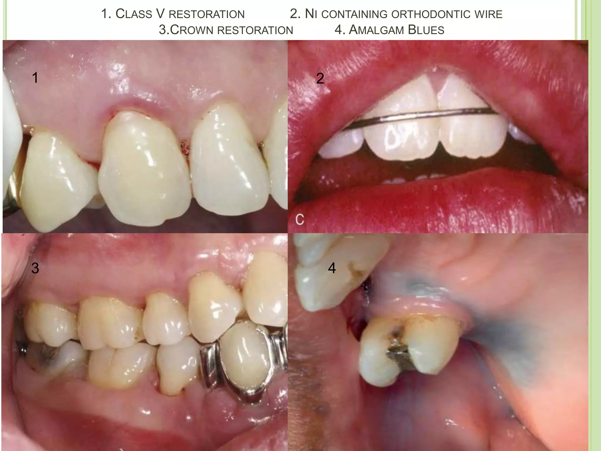 Biological, physical and chemical properties of dental materials. | PPTX