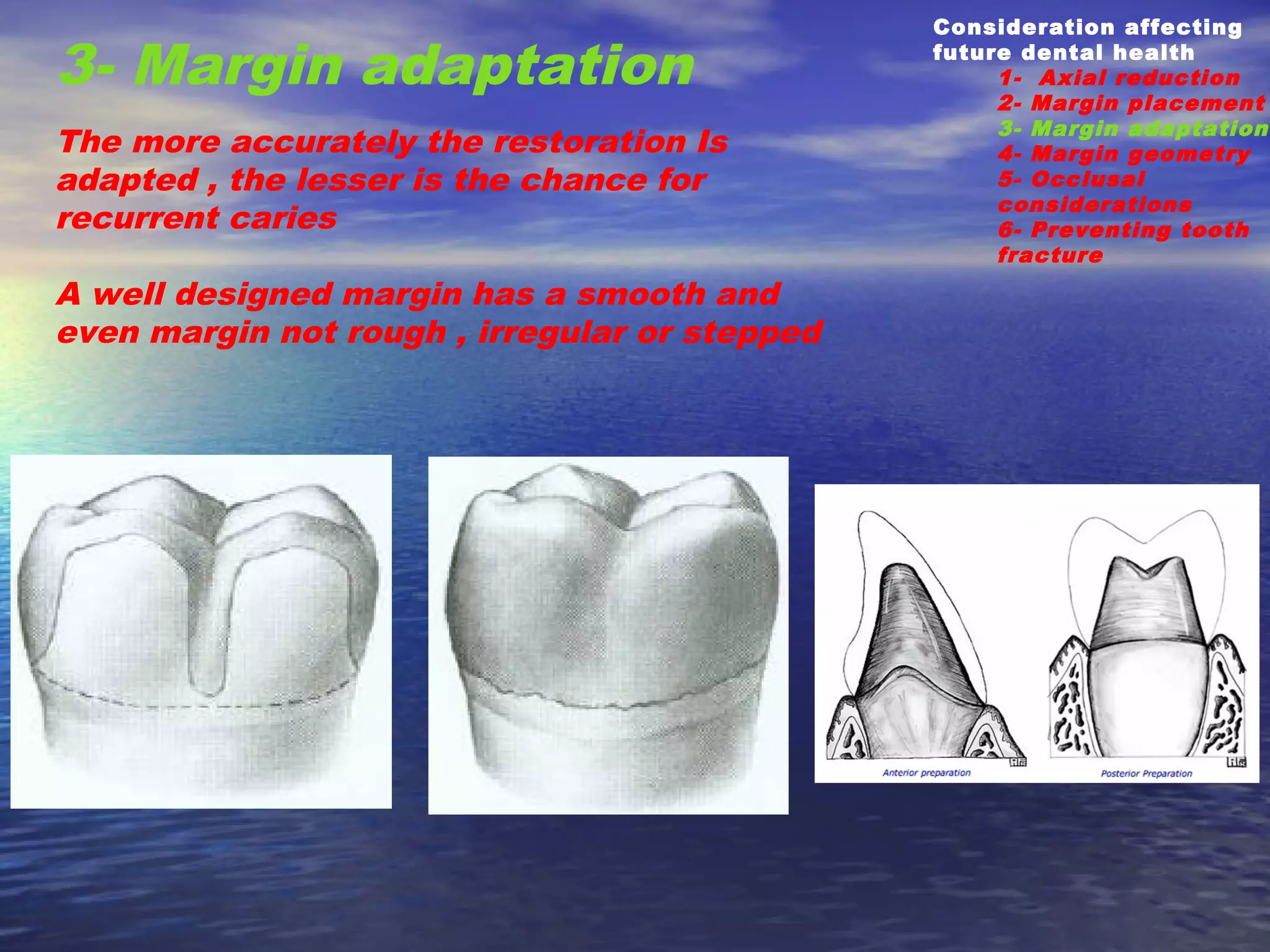 Biological principle of preparation ( crown ) | PPT