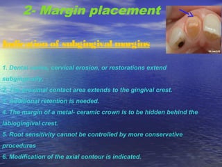 Biological principle of preparation ( crown ) | PPT