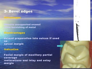 Biological principle of preparation ( crown ) | PPT