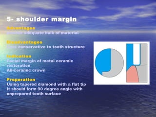 Biological principle of preparation ( crown ) | PPT