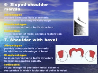 Biological principle of preparation ( crown ) | PPT