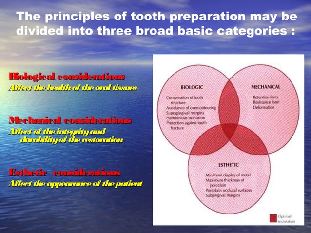 Biological principle of preparation ( crown ) | PPT | Dental Health ...