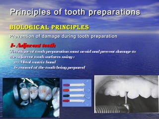 Biological principle of preparation ( crown ) | PPT