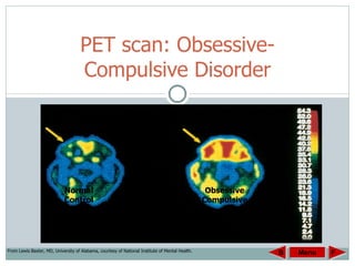 Biological theory of psychiatric illness | PPT