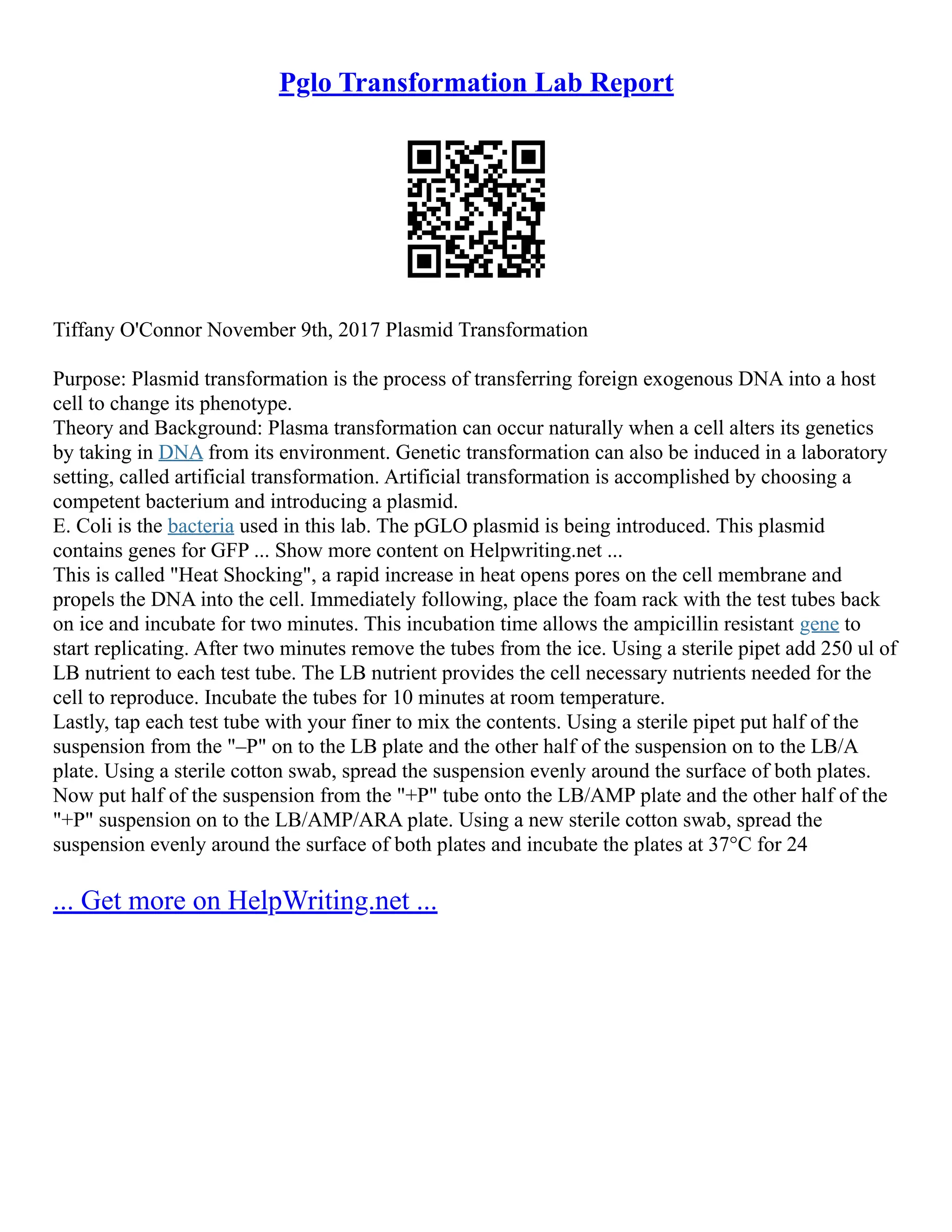 Biological Transformation Of Bacteria And Pglo Plasmid Dna | PDF