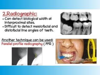 Biological width | PDF