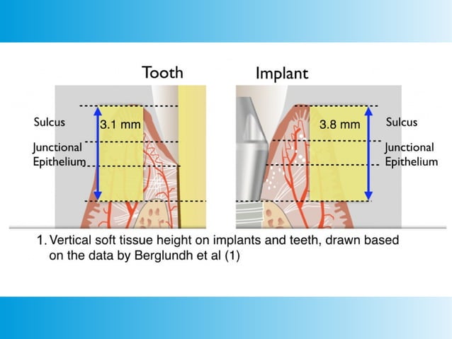 Biological width | PDF