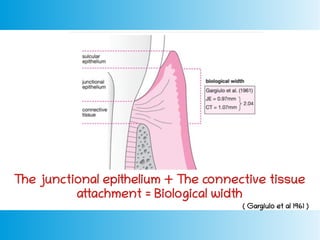 Biological width | PPT