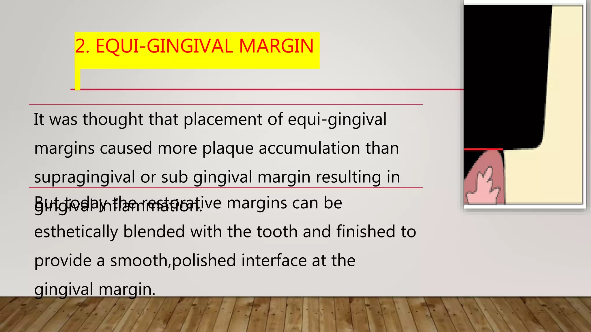 Biological width | PPTX