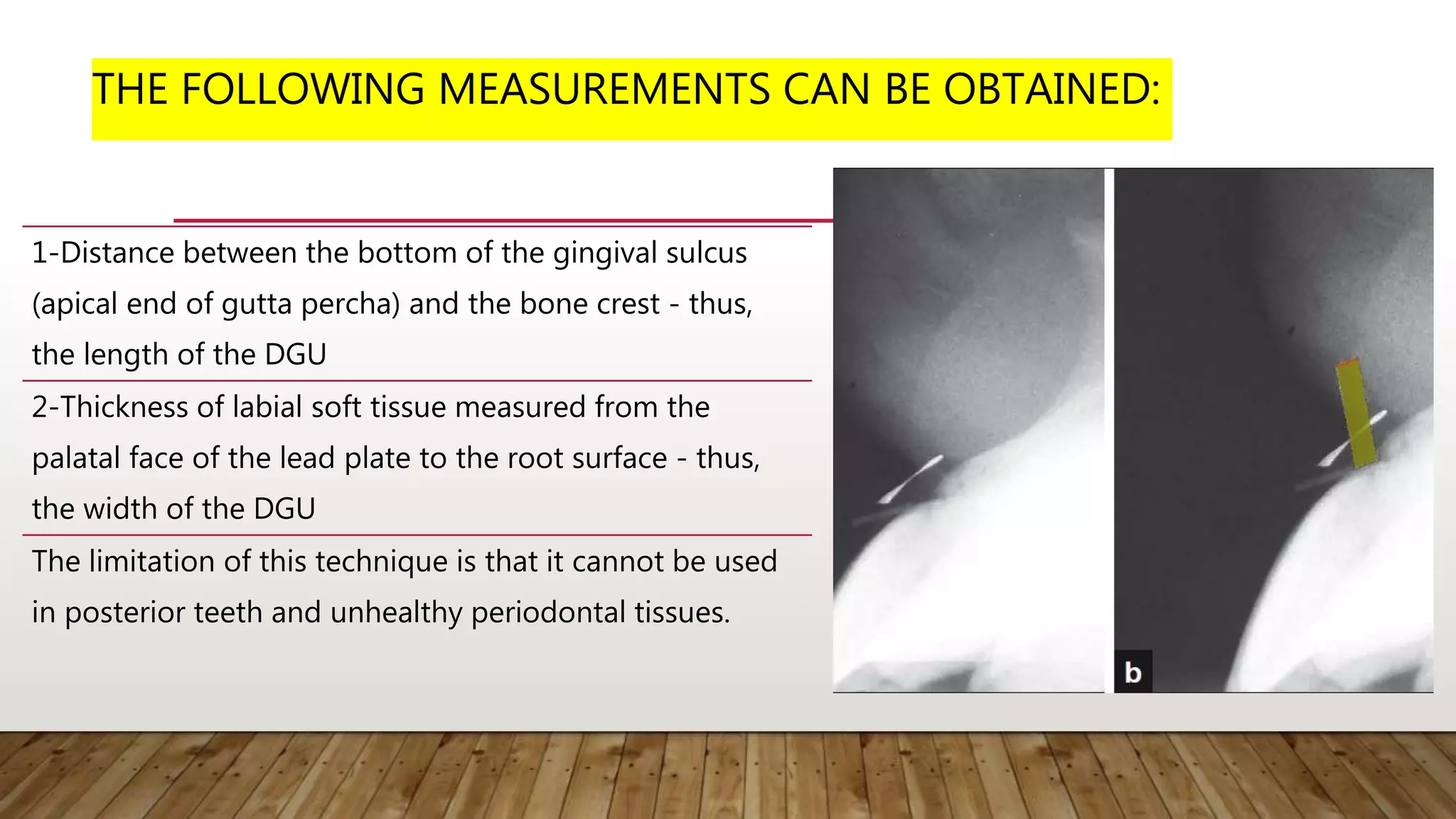 Biological width | PPTX