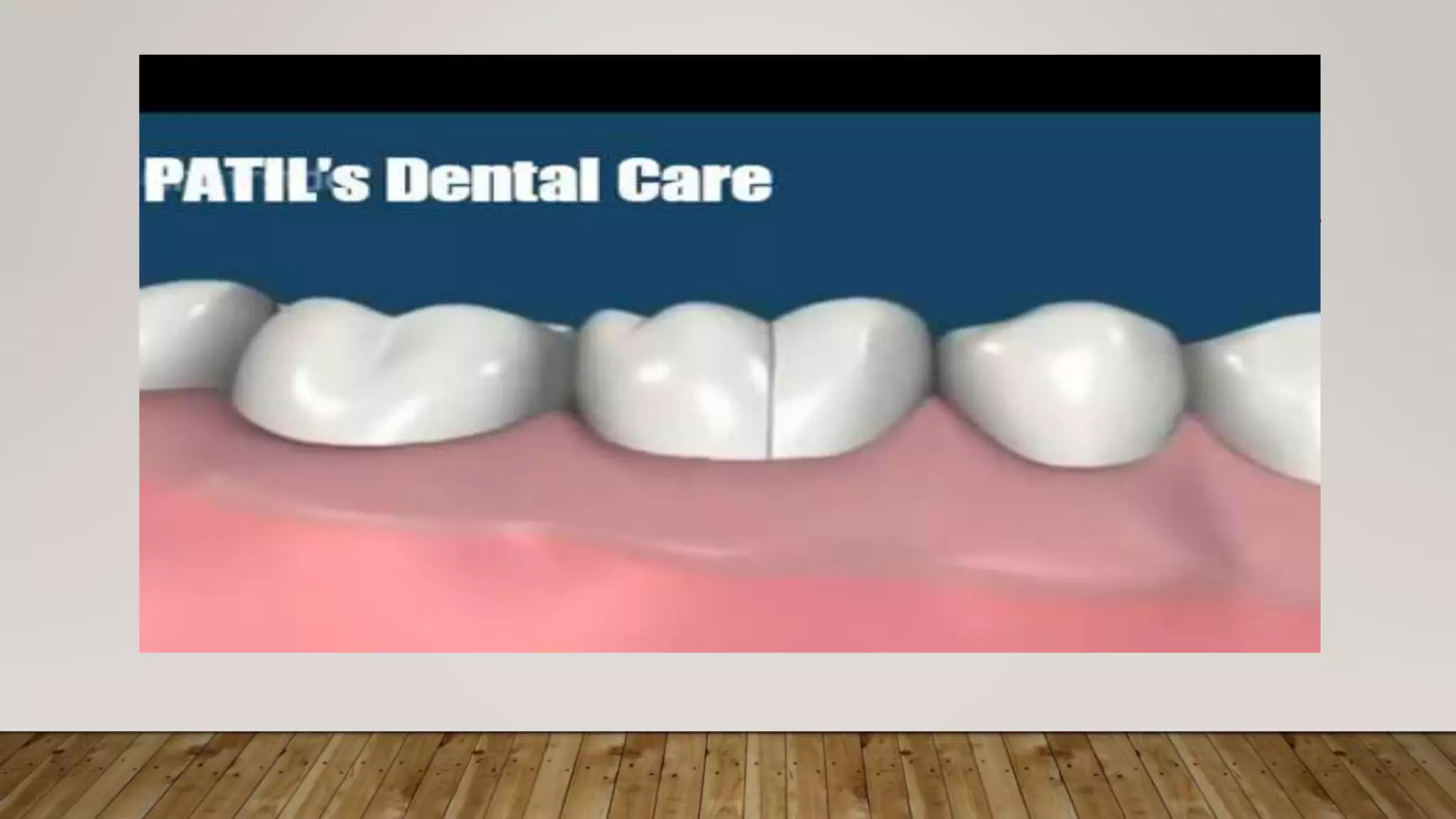 Biological width | PPTX