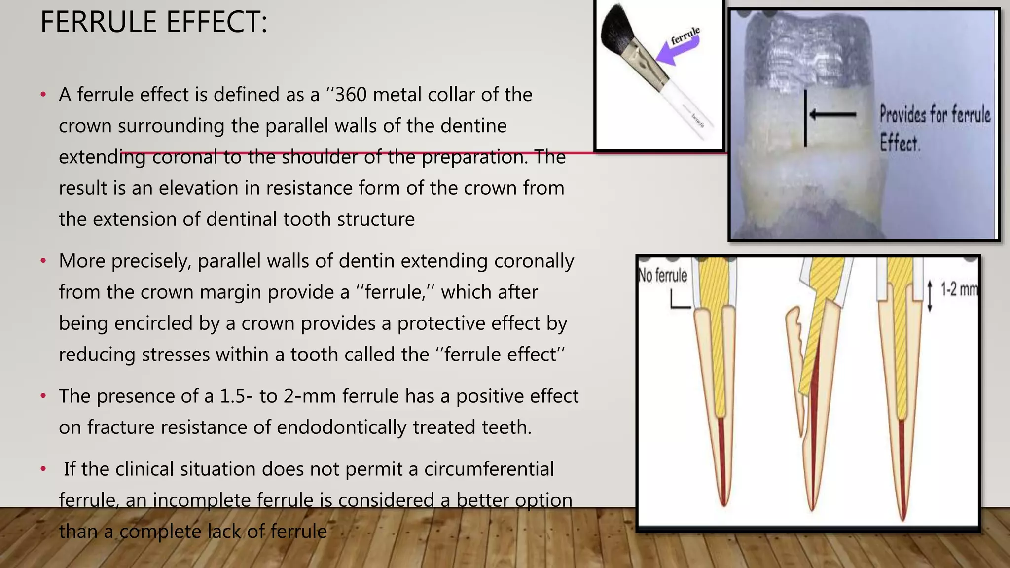 Biological width | PPTX