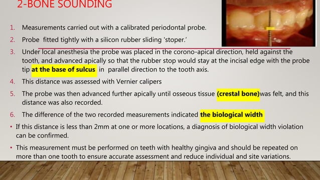 Biological width | PPTX | Dental Health | Diseases and Conditions
