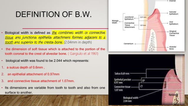 Biological width | PPTX | Dental Health | Diseases and Conditions