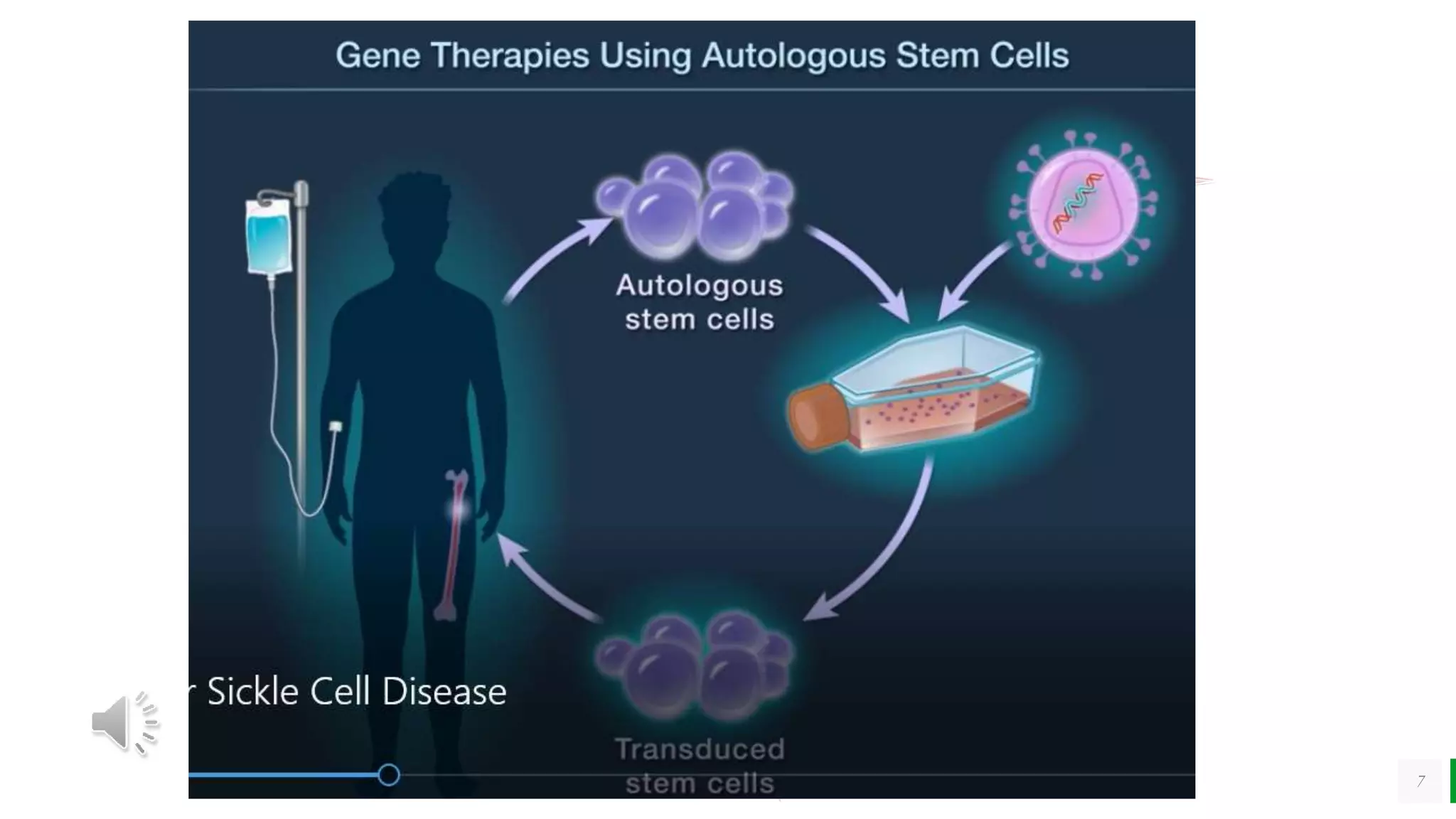 Biologic and Clinical Efficacy of LentiGlobin for Sickle.pptx