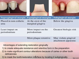 Biologic consideration | PPTX