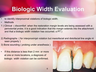 Biologic consideration | PPT