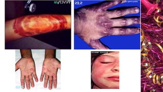 Biologic Effects of Radiation Exposure | PPTX