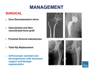 Bone Marrow Lesions of the Hip - Avascular Necrosis and Subchondral ...