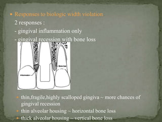Biologic width | PPTX