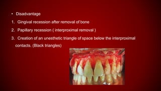 Biologic width | PPTX