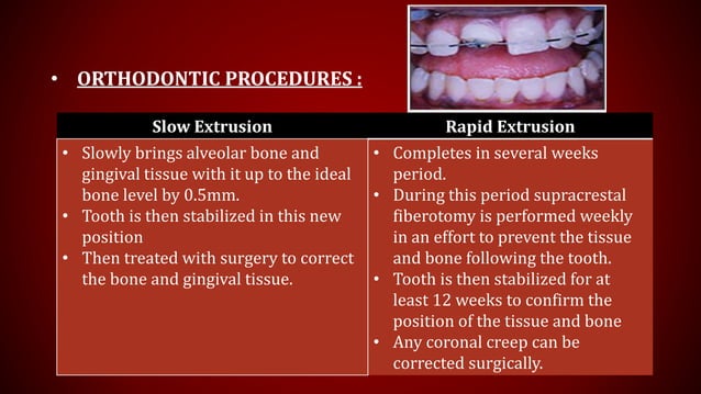 Biologic width | PPTX