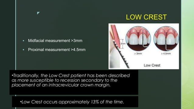 Biologic width | PPTX