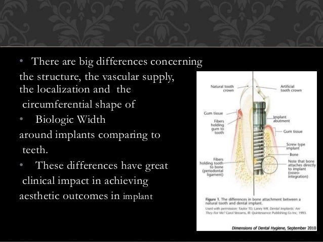 Biologic width 2