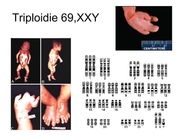 Biologie pro bakaláře - Cytogenetika I | PPT