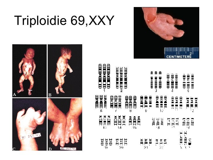 Biologie pro bakaláře - Cytogenetika I