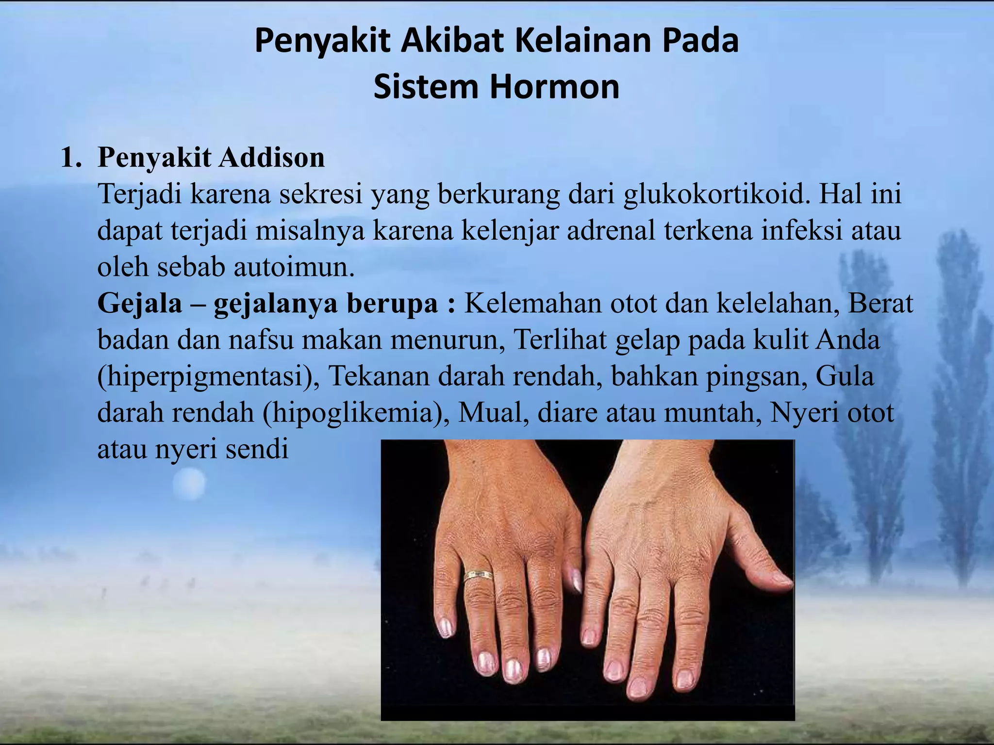 Sistem Regulasi Hormon | PPTX