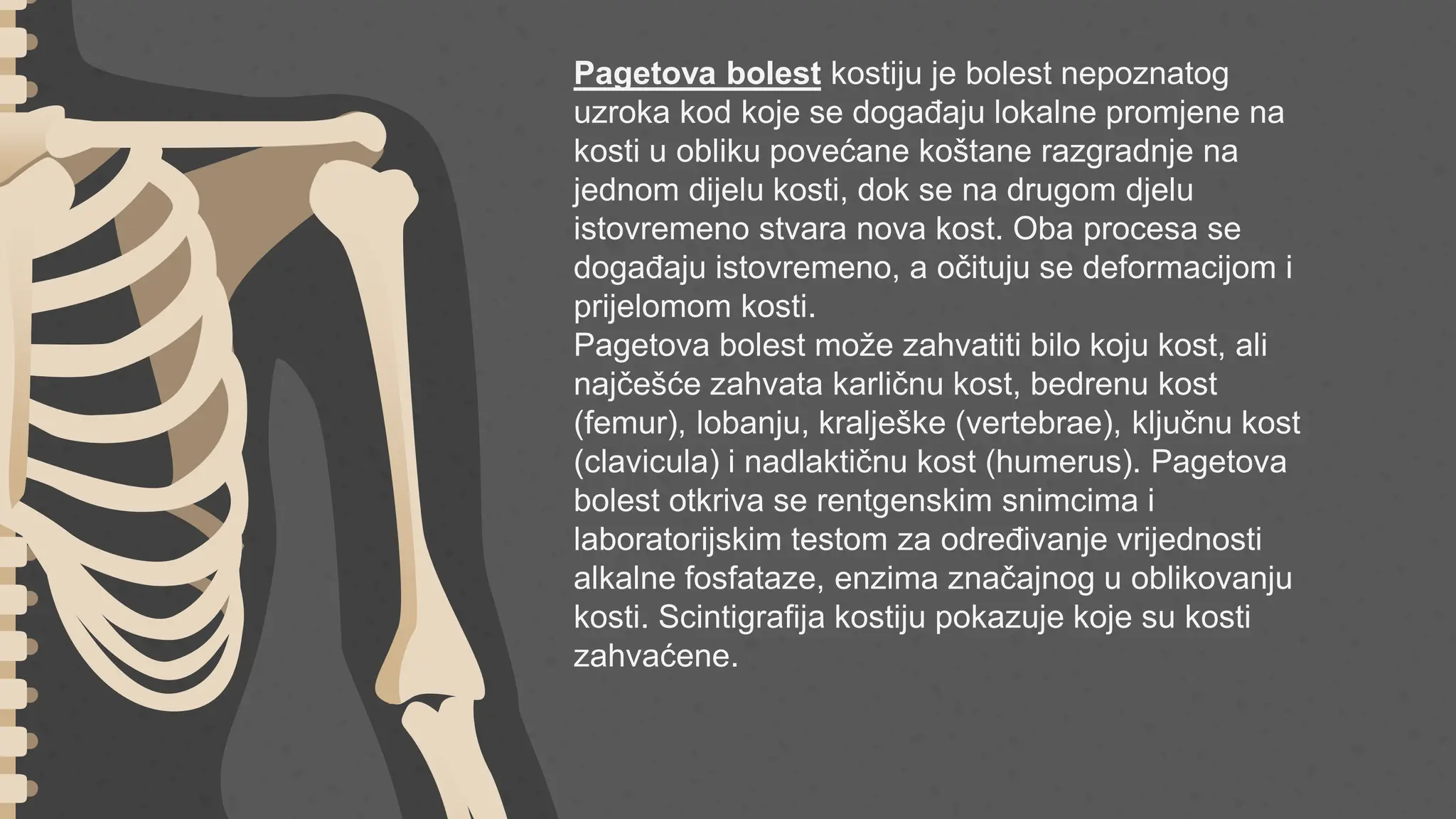 Prezentacija iz biologije zastita skeletnog sistema | PPTX
