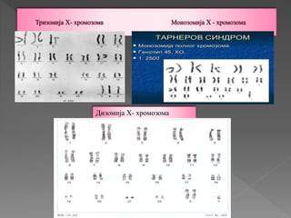 1) Strukturne aberacije hromozoma i 2)Numeričke aberacije hromozoma | PPTX