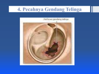 materi alat indra | PPTX